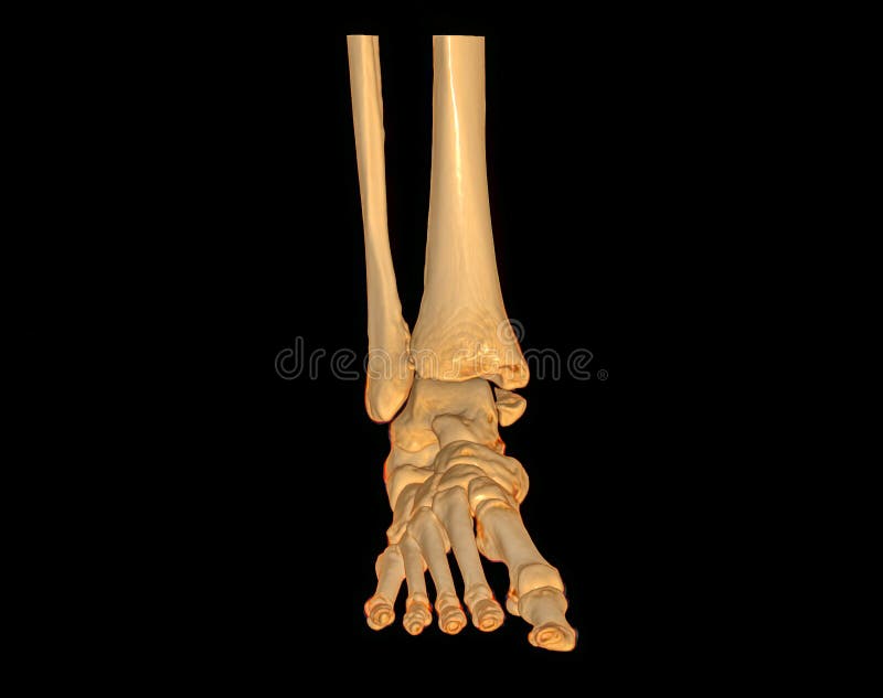 Ct Scan Ankle And Foot Stock Illustration Illustration Of Metatarsal 256462437