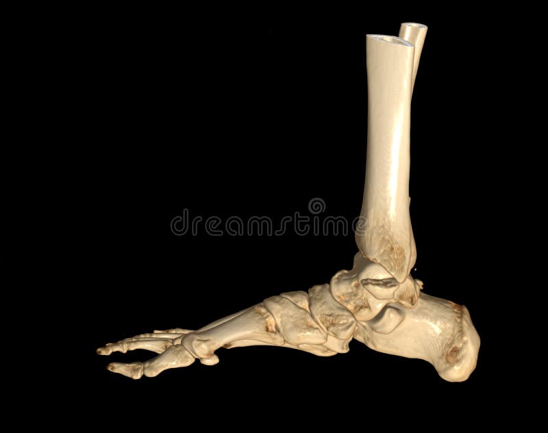 Ct Scan Ankle And Foot Stock Illustration Illustration Of Arthritis 256462422