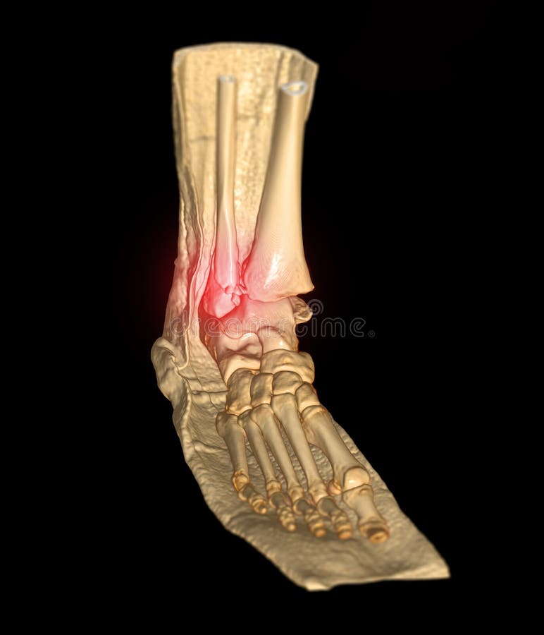 Ct Scan Ankle And Foot Stock Illustration Illustration Of Arches 256462429
