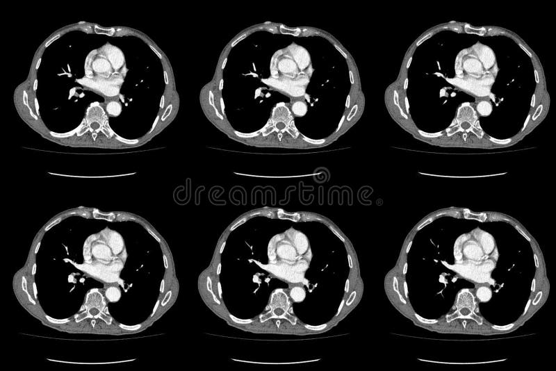 Computed Tomography CT Whole Abdomen in Axial. Part Eight Stock Photo ... Computed Tomography CT Whole Abdomen in Axial. Part Eight Stock Photo ...