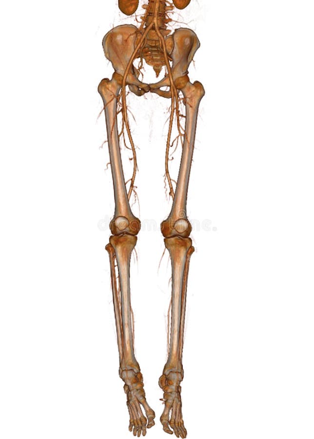 CT SCAN 3D Rendering Image of Lower Extremity. Stock Illustration ...