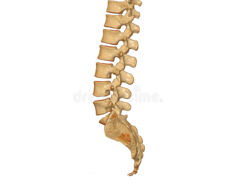 Ct Scan Of Lumbar Spine 3d Rendering Showing Profile Human Spine Stock Illustration