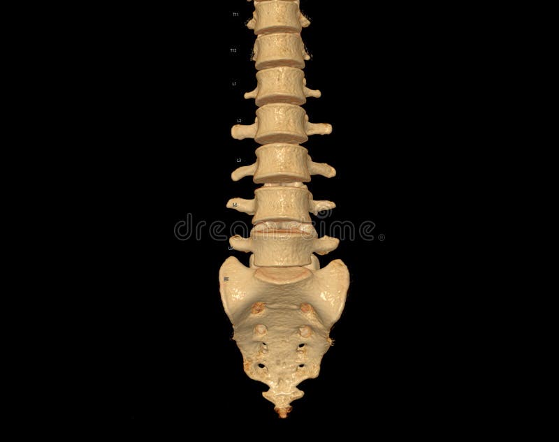 Ct Scan Of Lumbar Spine 3d Rendering Showing Profile Human Spine Stock Illustration