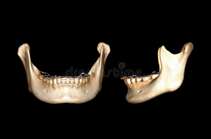 Anatomy Bone Male Mandible Skull Stock Illustrations – 154 Anatomy Bone ...