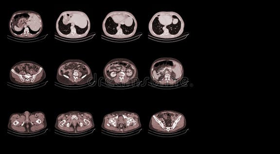 Ct scan of a old man stock image. Image of people, brain - 14220101