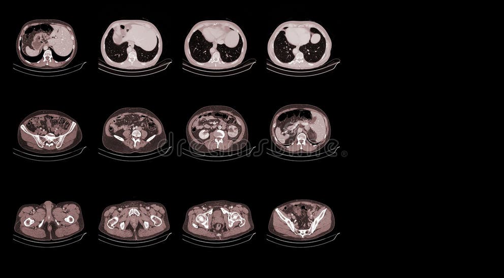 Ct scan of a old man stock image. Image of people, brain - 14220101