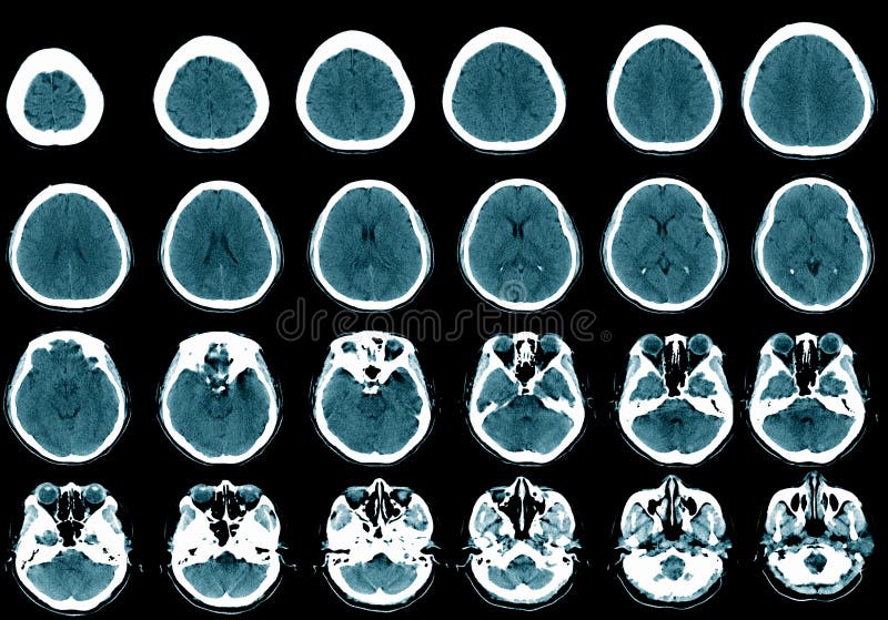 4,073 Ct Scan Man Stock Photos - Free & Royalty-Free Stock Photos from ...