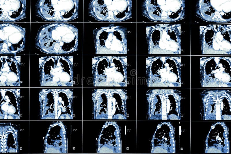 CT Scan of Patient Background Stock Image - Image of health, diagnosis ...