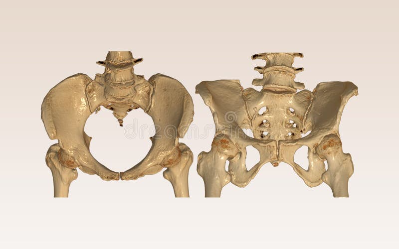 CT Scan of Pelvic Bone with Both Hip Joint 3D Rendering Image Inlet and ... CT Scan of Pelvic Bone with Both Hip Joint 3D Rendering Image Inlet and ...