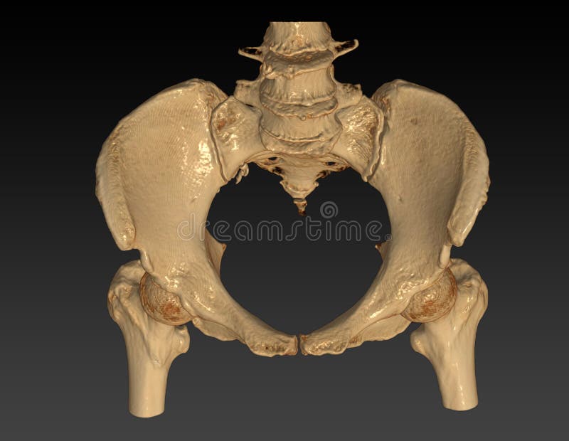 Ct Scan Of Pelvic Bone And Hip Joint 3d Rendering For Diagnosis