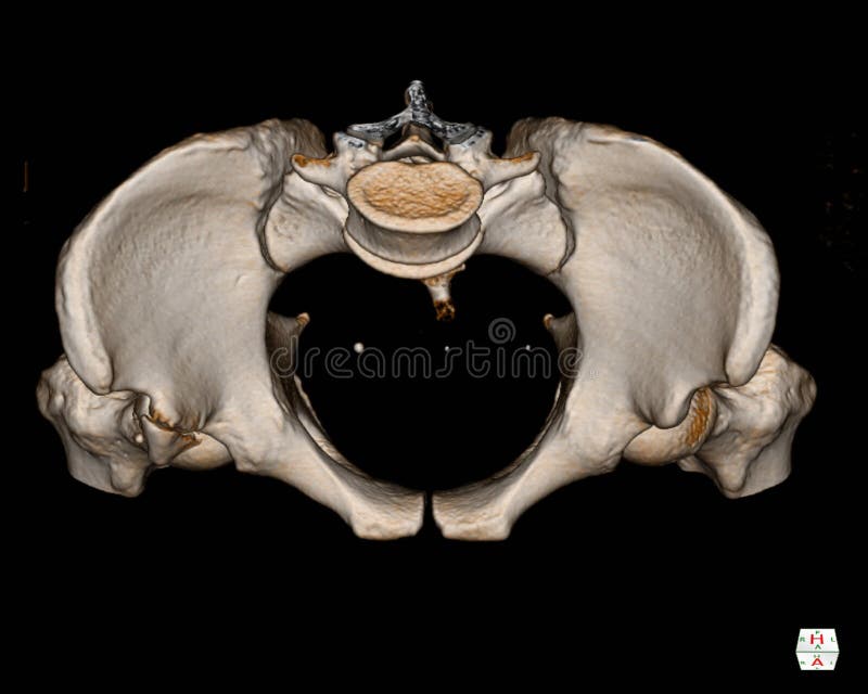 CT Scan Pelvis Bone 3D Rendering Image Isolated on Black Background ...