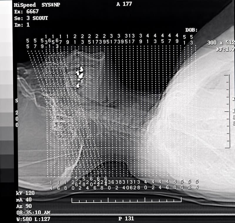 CT Scan Scout stock photo. Image of jaws, number, computerized - 6452568