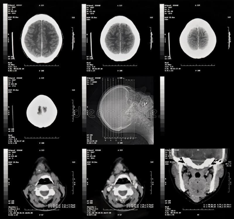 CT Scan Scout 7 stock photo. Image of computed, iodine - 6494824