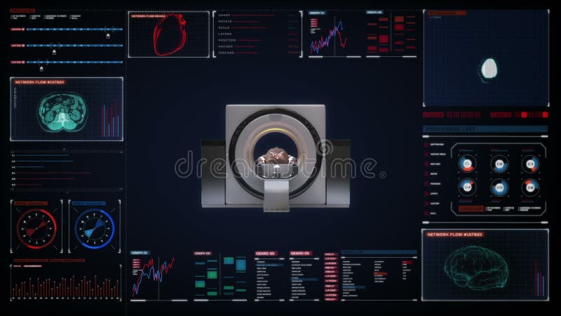X-ray CT Scanner, Medical Diagnosis Technology.MRI,white.1 Stock Video ...