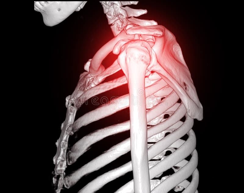 CT Shoulder 3D stock illustration. Illustration of examination - 257208897