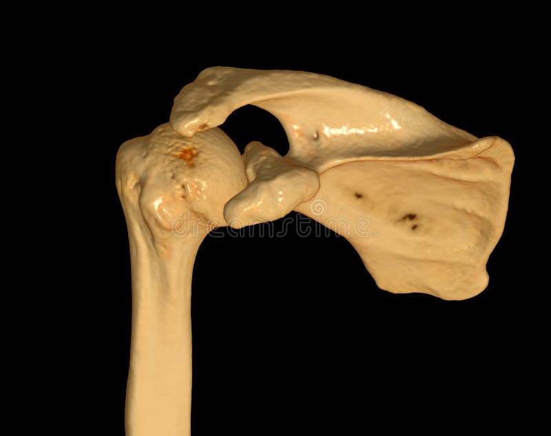 CT Shoulder 3D stock illustration. Illustration of accident - 257208905