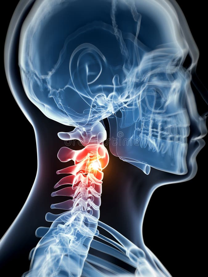 Cuello destacado stock de ilustración. Ilustración de salud - 30722171