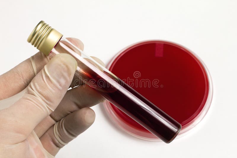 Culture Media in Plate and in Tube for Biological Samples Stock Image ...