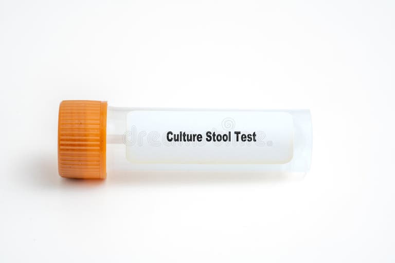 Culture Stool Test. Culture Stool Test Stock Photo - Image of ...