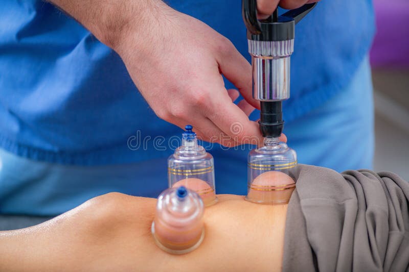 Cupping Therapy on the Knee is Applied during a Physical Therapy ...