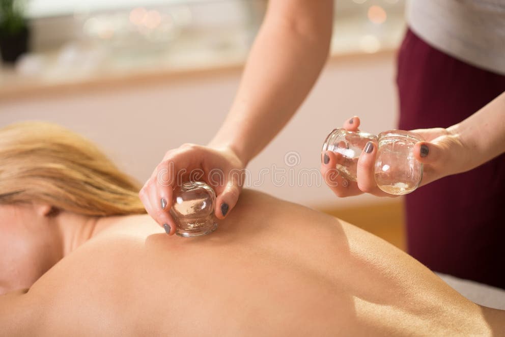 Cupping therapy stock photo. Image of comfort, caucasian - 54457636
