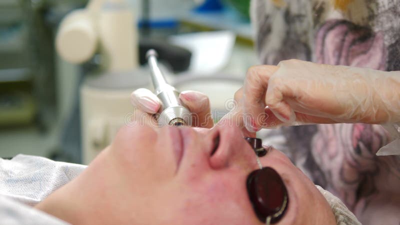 Curing Rosacea with Modern Laser Technology in Modern Beauty Clinic ...