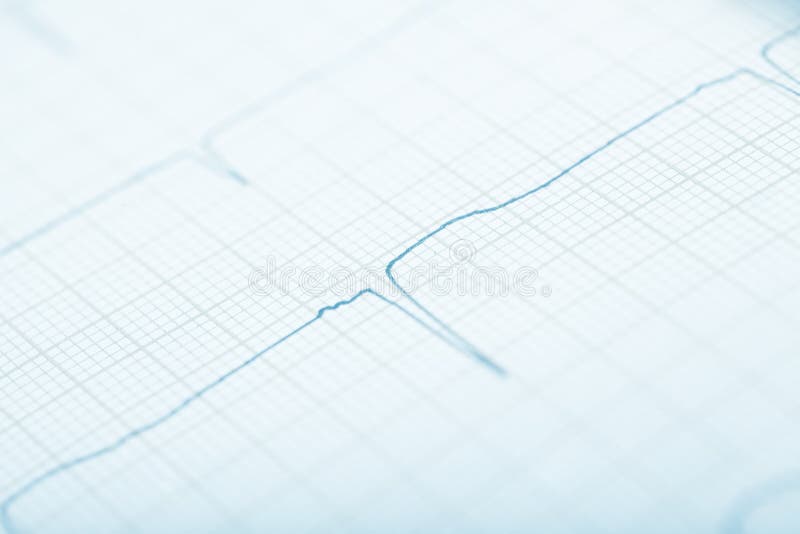Curve Line On The Graph Paper Stock Image - Image of empty, graphic ...