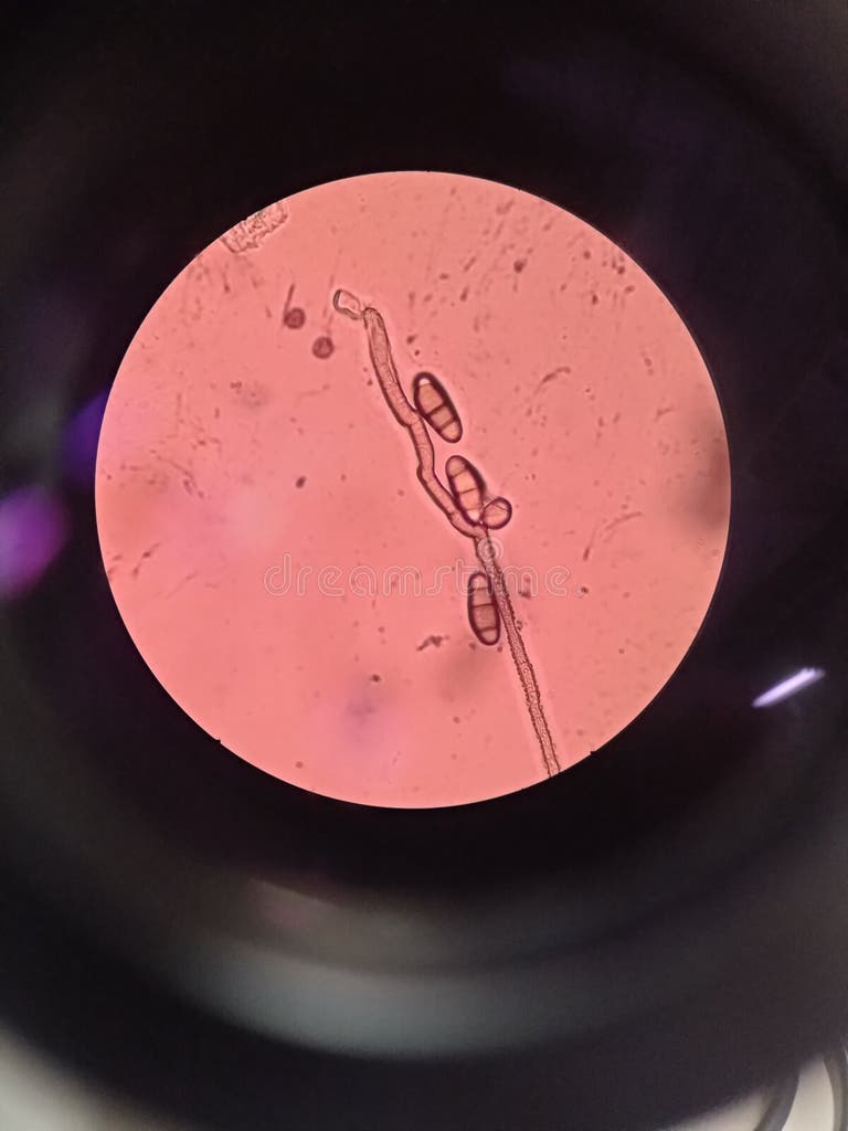 Curvularia Sp Agar Stock Photos - Free & Royalty-Free Stock Photos from ...