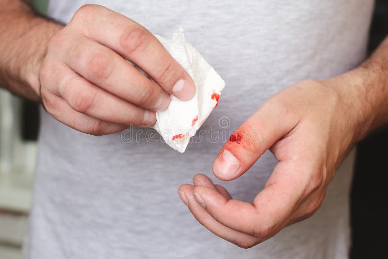 363 Bleeding Finger Photos - Free & Royalty-Free Stock Photos from ...