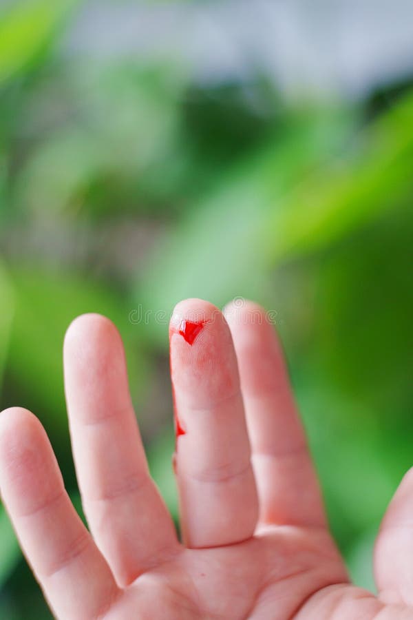 Blood Injury Bloody Hand Cut Stock Photos - Free & Royalty-Free Stock ...