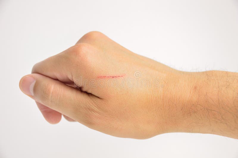 With a cut hand stock image. Image of homicide, accident - 102062521