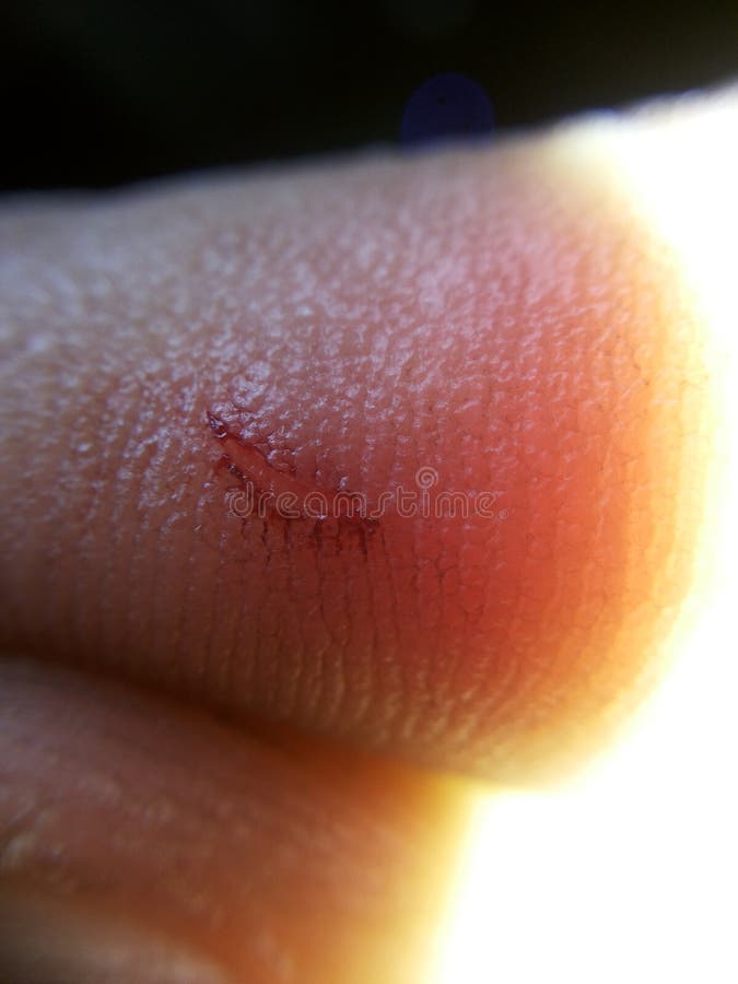 Cut stock image. Image of open, finger, blood, liter - 43381201