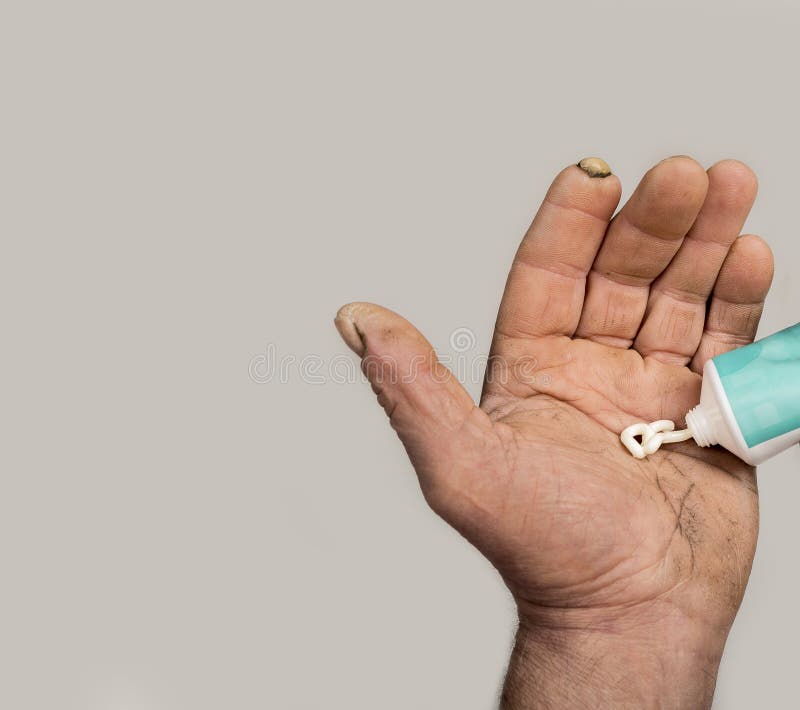 Cut Tip of the Finger. Overworked Hand with a Cream Stock Image - Image ...