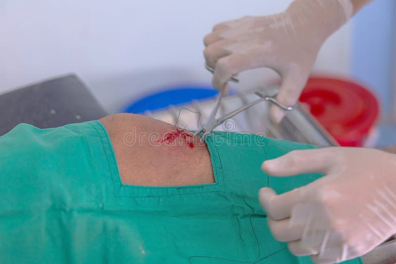 Cut wound dressing stock photo. Image of care, surgery - 197919400