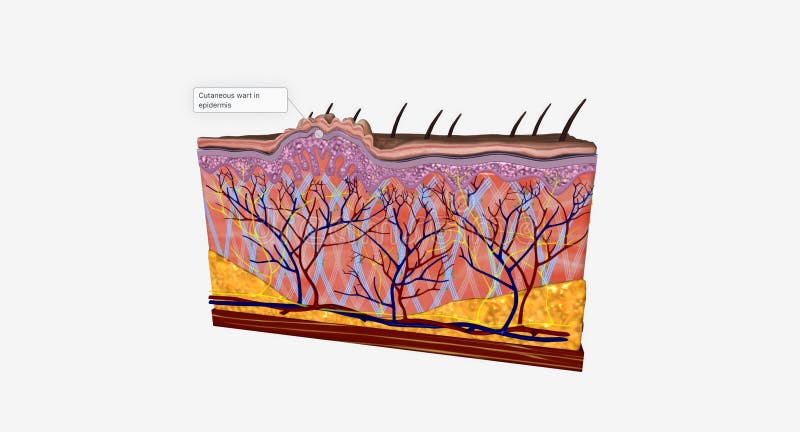Epidermis Aids Stock Illustrations – 13 Epidermis Aids Stock ...