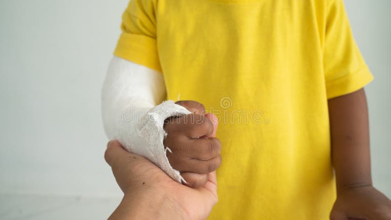 Boy Hand Bone Broken from Accident with Arm Splint Stock Image - Image ...
