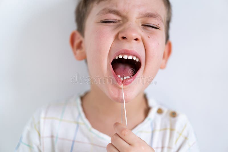 Cute Boy Pulling Loose Tooth Using a Dental Floss. Process of Removing ...
