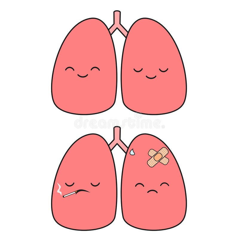 COPD Vector Illustration. Labeled Chronic Obstructive Pulmonary ...