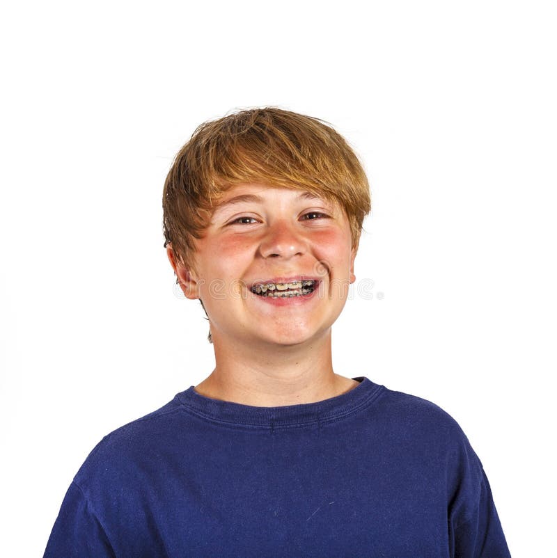 114 Teen Boy Retainer Stock Photos - Free & Royalty-Free Stock Photos ...