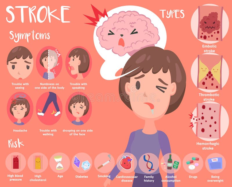 Stroke infographic stock vector. Illustration of headache - 137374455