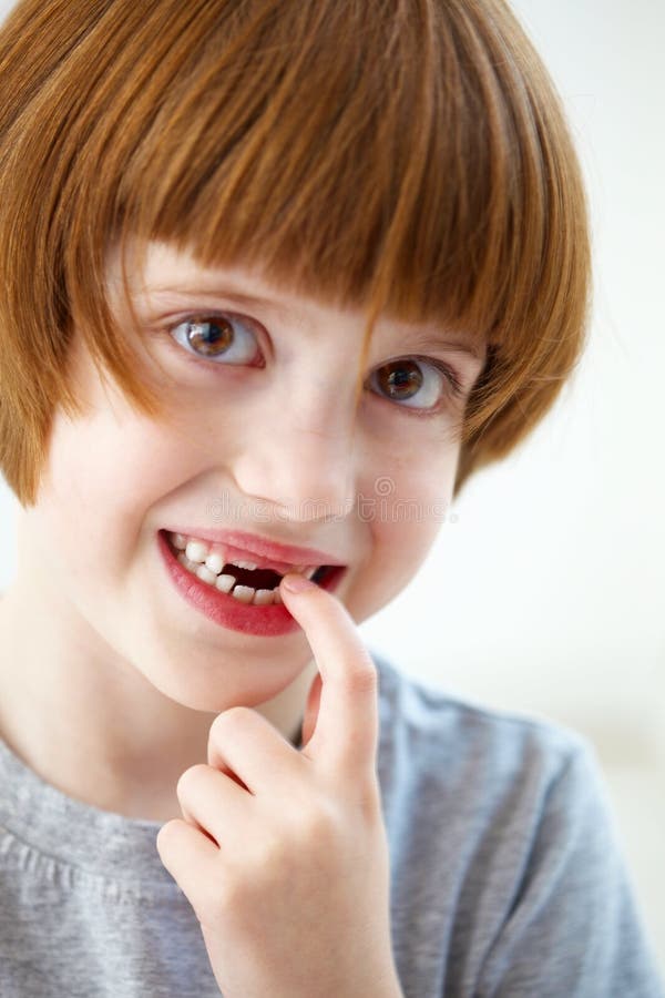 Cute Smiling Girl Missing Front Teeth Stock Photo - Image of looking ...