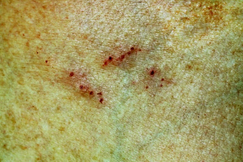 Cuts And Scratches On The Skin. Wounds And Abrasions Stock Image ...