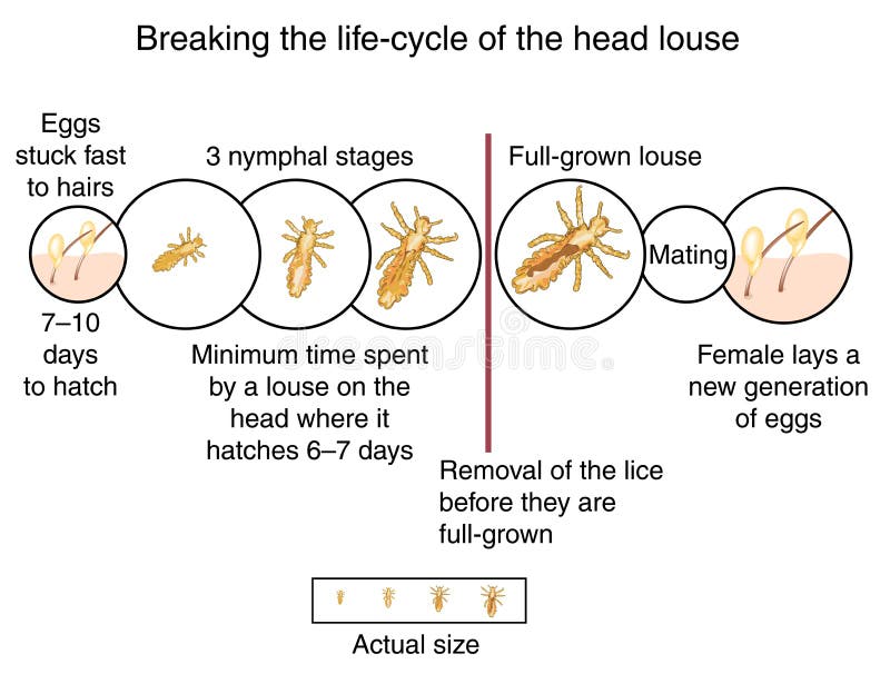 Anatomie D'insecte Pou Humain Principal D'autocollant Capitis De ...