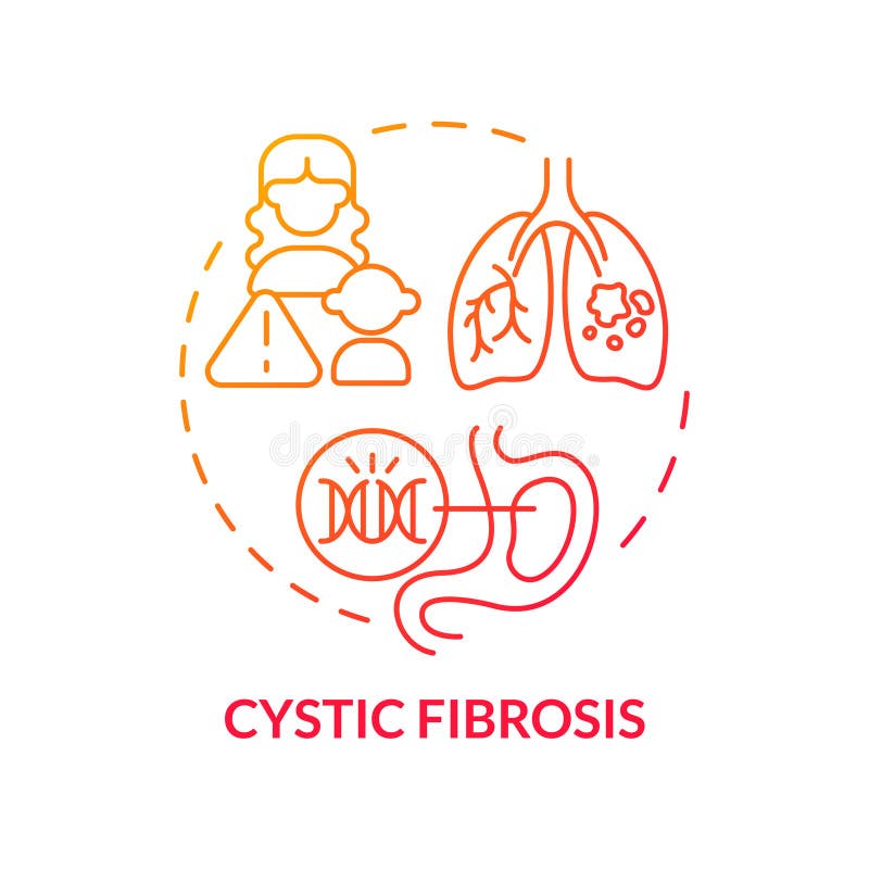 Cystic Fibrosis Red Gradient Concept Icon Stock Vector - Illustration ... Cystic Fibrosis Red Gradient Concept Icon Stock Vector - Illustration ...