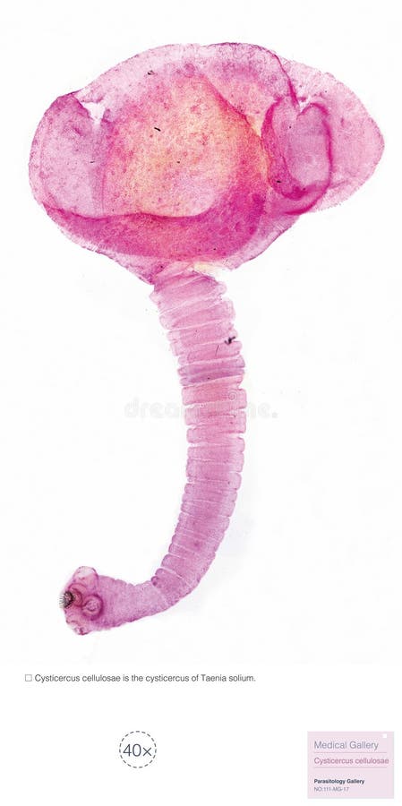 Cysticercus cellulosae stock photo. Image of parasitology - 367711118