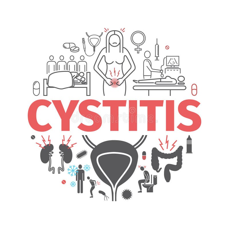 Cystitis Banner. Symptoms, Treatment. Vector Signs for Web Graphics ...