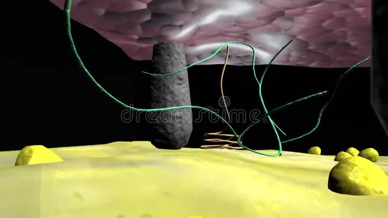 3d Animation of Hair Loss Proceeded by Nutrient Deficiency. Dermatology ...