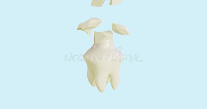 3d Animation of Tooth Destruction, Preparation of the Filling, the ...