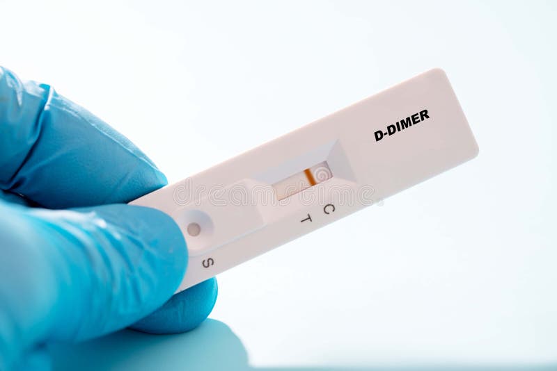D-Dimer Rapid Test Cassette in Doctor Hand Stock Photo - Image of ...