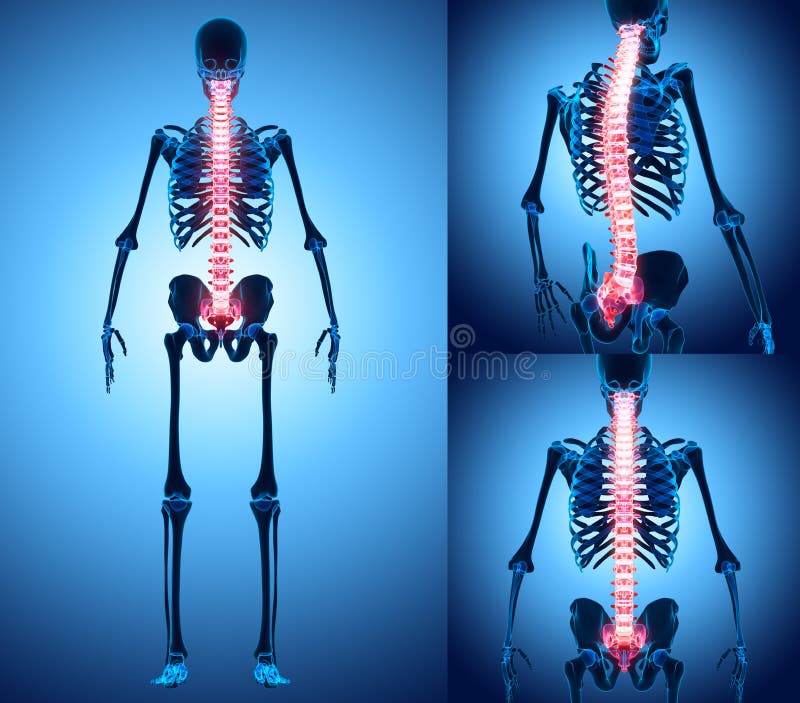 3D Ejemplo De La Espina Dorsal, Concepto Médico Stock de ilustración ...